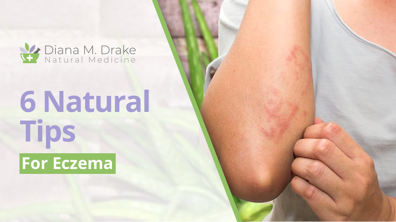 6 Natural Tips for Eczema